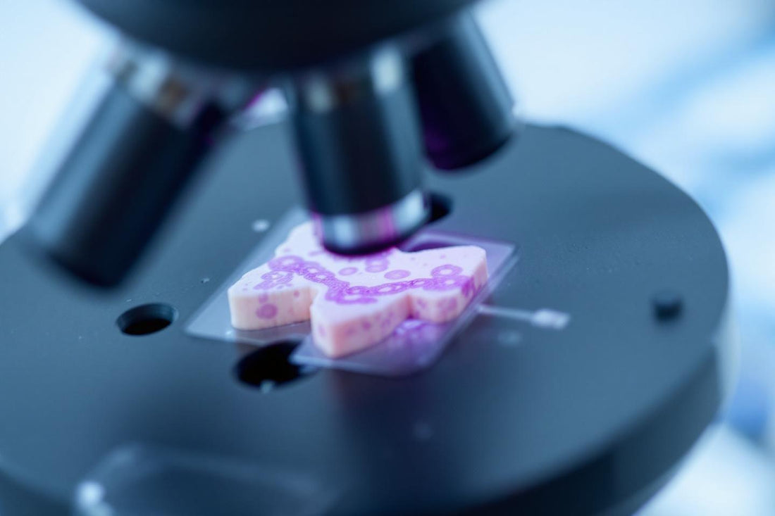 Biopsie : qu'est-ce que c'est, comment se déroule cet examen médical e ...