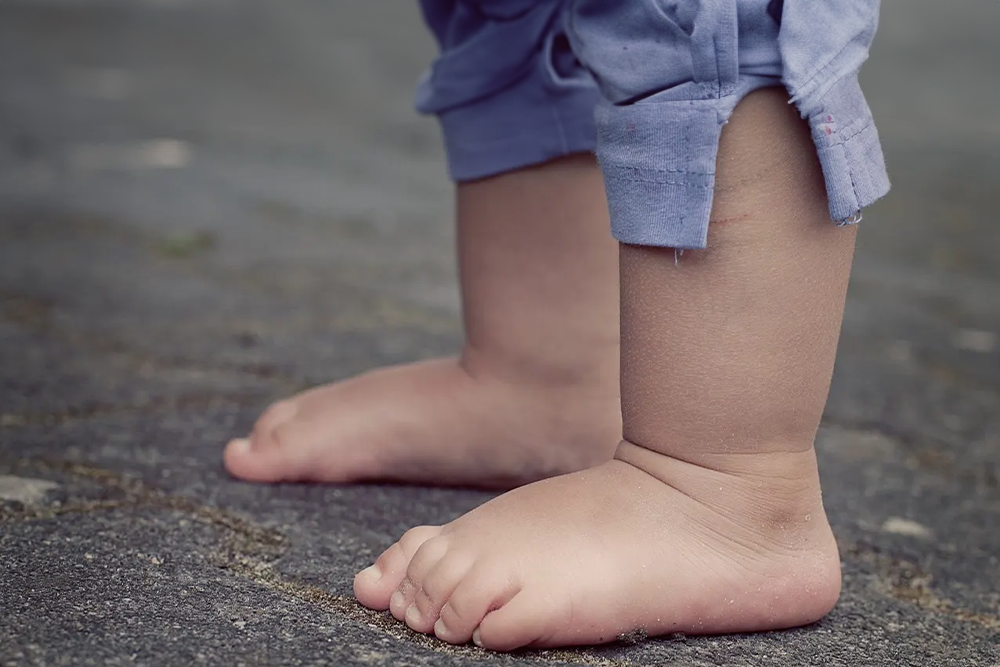 Comment soulager un pied gonflé et douloureux ? - Conseils et astuces ...